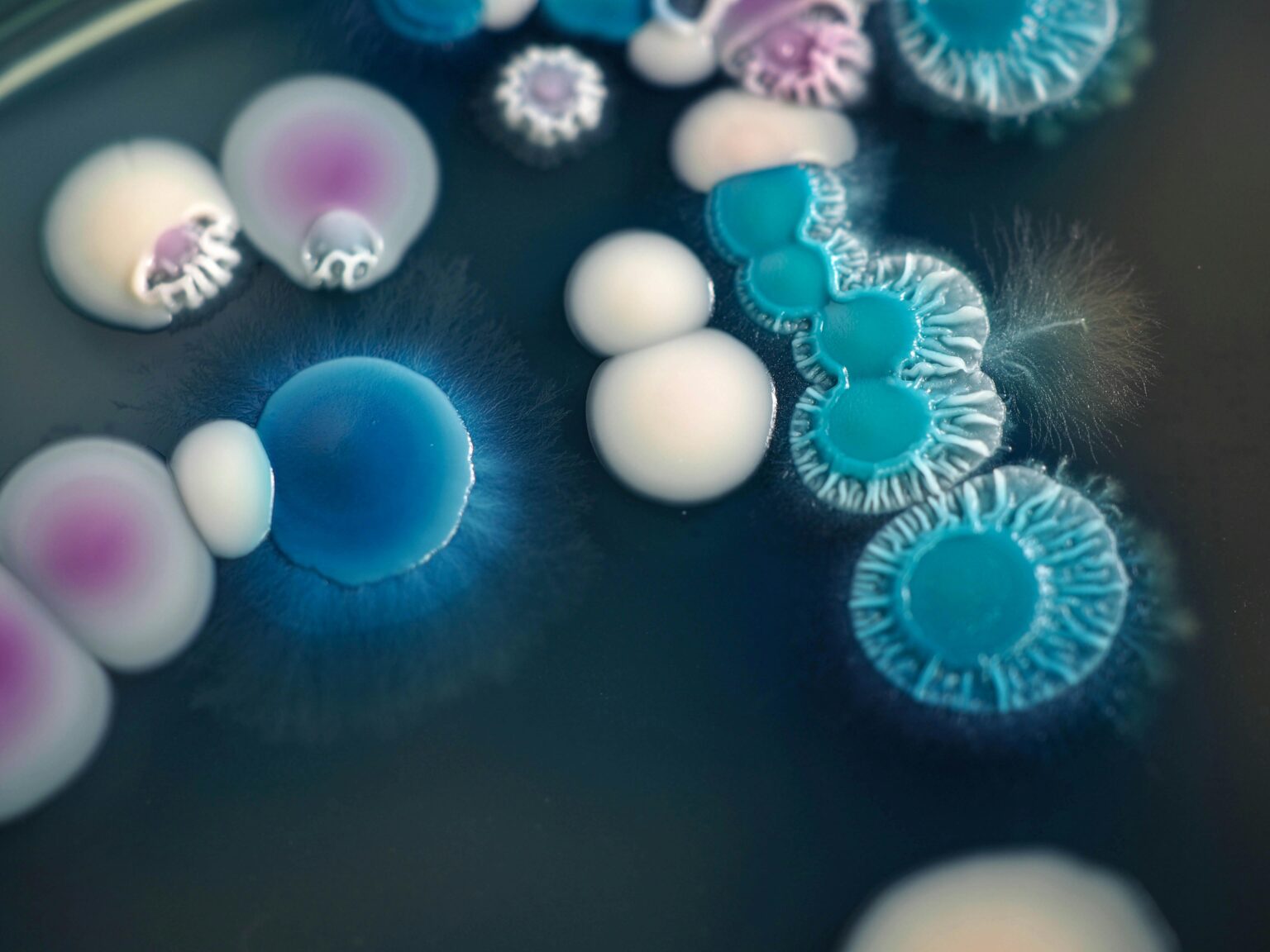 Fungal infections are killing millions. Why don’t we have more ...